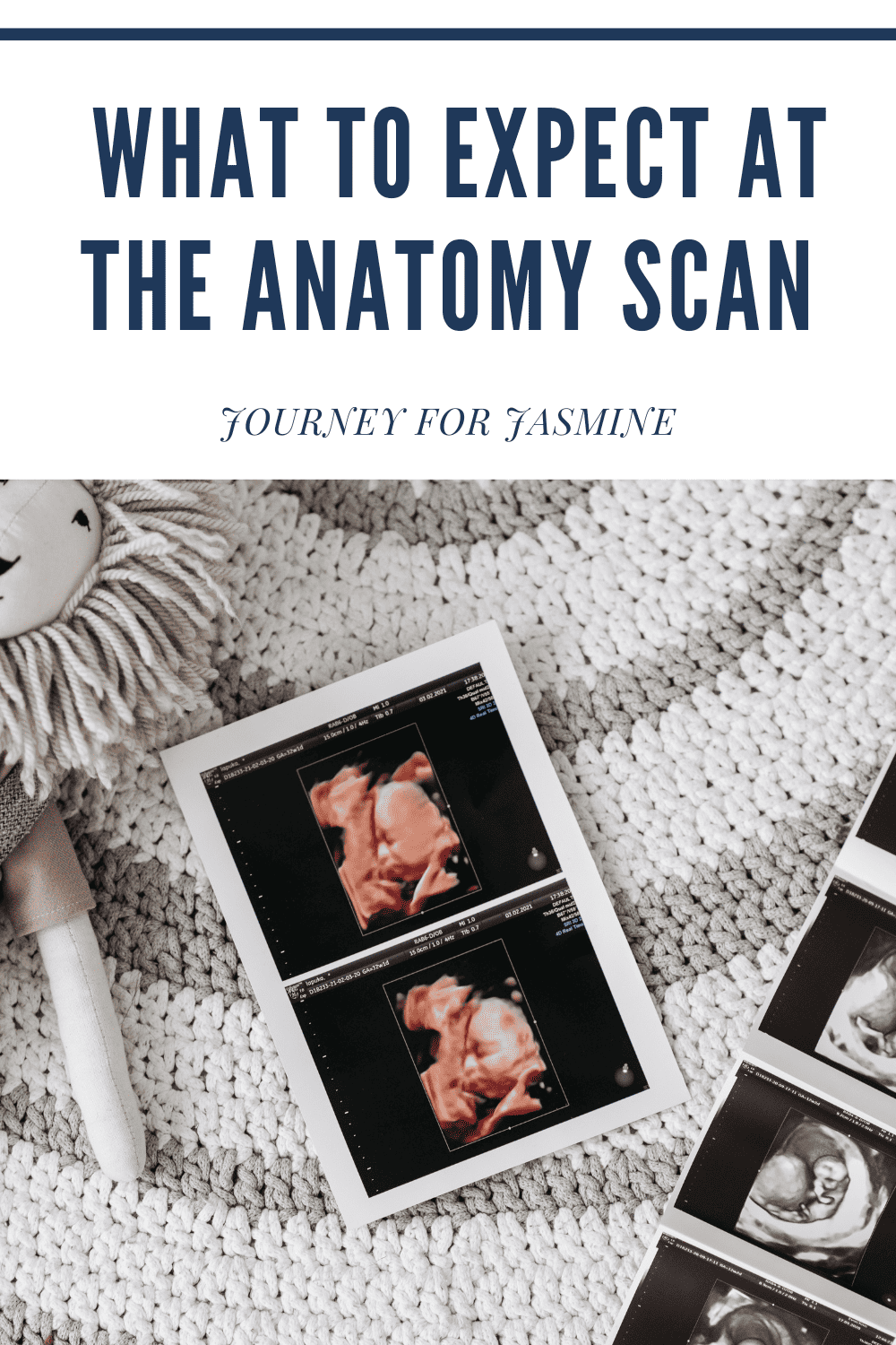 19 Weeks Pregnant Ultrasound Scan: What to Expect – Journey for Jasmine